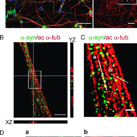 α Synuclein Colocalized With Acetylated α Tubulin Along The