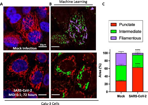 SARS CoV 2 Infection Of Calu 3 Human AEC Causes Mitochondrial Fission