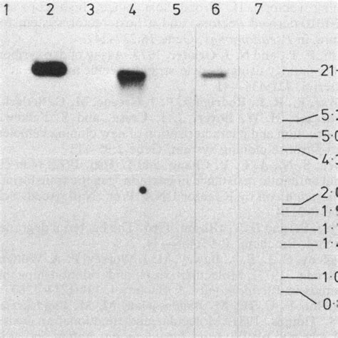 Southern Hybridization Analysis Of Xhoi Digested Plasmid Dna The Probe