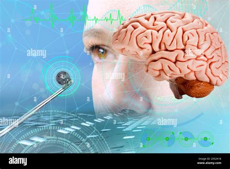 Electronic Chip Bug In Scientists Hand Successful Implantation Of