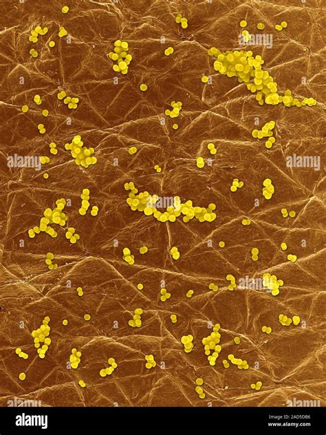Coloured Scanning Electron Micrograph Sem Of Photocomposite Staphylococcus Aureus On The