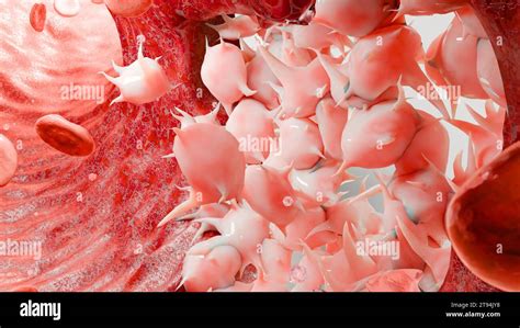 Hemostasis Red Blood Cells And Platelets In The Blood Vessel