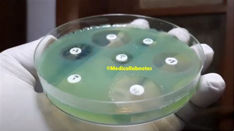 Ast Pattern Of Bacteria Introduction Group Of Ast Pattern List Of