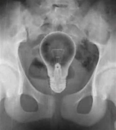 Wild X Ray Imagery Klykercom