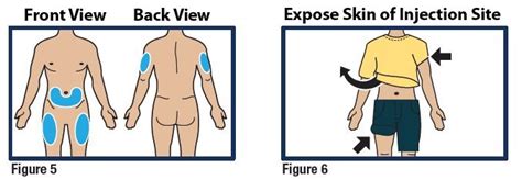 Gvoke Injection Package Insert Prescribing Information