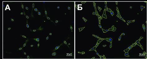 An Example Of The Macros Operation For Counting Nuclei Stained With