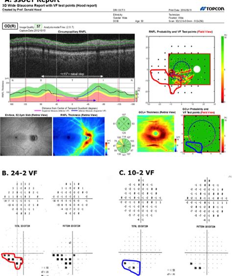 Figure 6 From A Single Wide Field Oct Protocol Can Provide Compelling Information For The