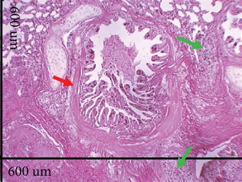 Photomicrographs Of Lungs Of Guinea Pigs From Ctrl A Asth B