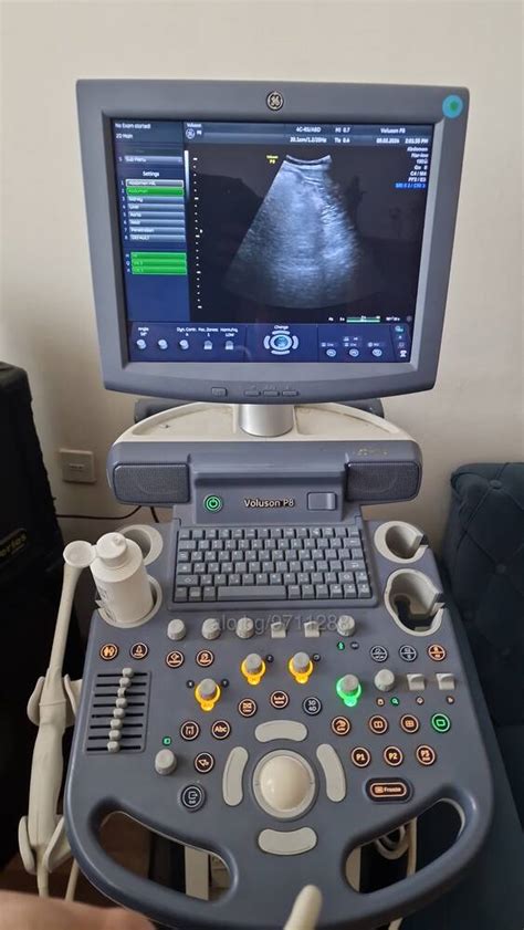 Продавам ехограф Медицинско оборудване Пловдив
