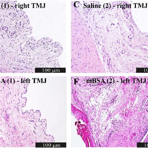 Photomicrographs Of The Tmj Synovial Membrane A Normal Tmj Synovial