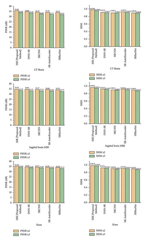 Psnr And Ssim Values For X And X For The Sota And Proposed Method