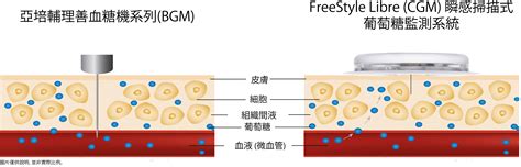 FreeStyle 的作用原理 FreeStyle Libre 亞培