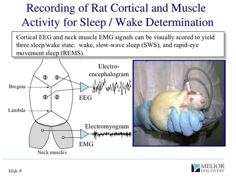 Eeg Sleep Wake Evaluation