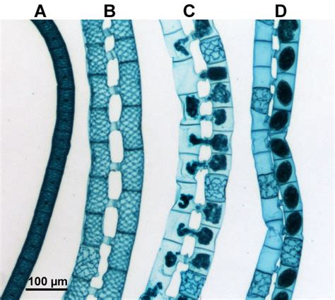 Spirogyra Conjugation Under Microscope