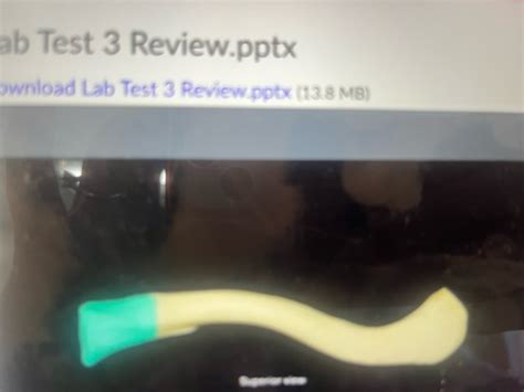 Lab Test 3 Flashcards Quizlet