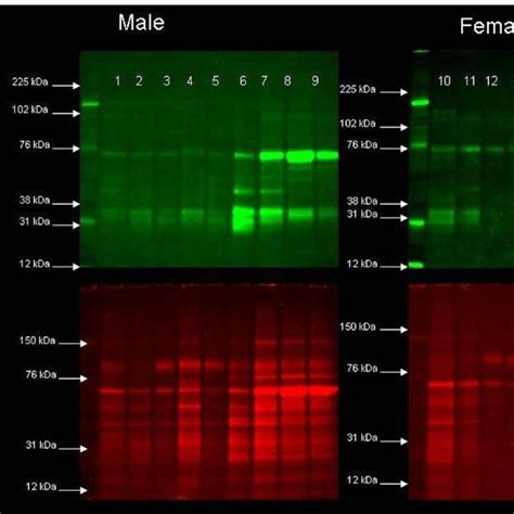 Overview Of Activity Based Protein Profiling Download Scientific Diagram