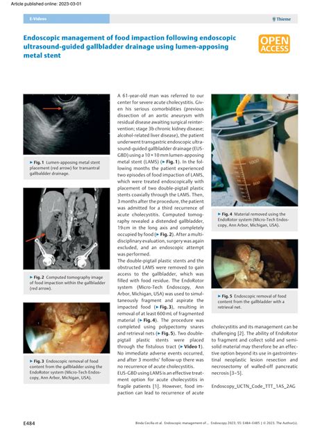 Pdf Endoscopic Management Of Food Impaction Following Endoscopic
