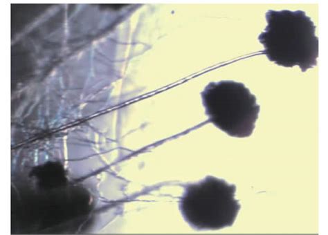1562C0001000000168 3 黑曲霉 微生物菌种 图片