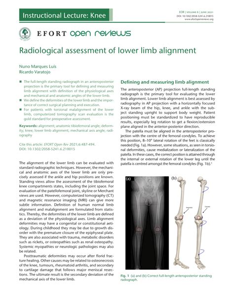 PDF Radiological Assessment Of Lower Limb Alignment