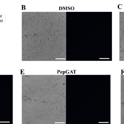 Effect Of The Antioxidant Agent Ascorbic Acid In The Activity Of