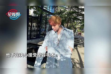28岁男子长相丑陋遭嘲笑11年整容10次改头换面如今酷似男明星 长相 男子