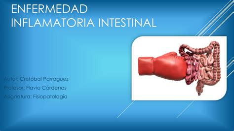 Enfermedad Inflamatoria Intestinal Cris Parraguez Udocz