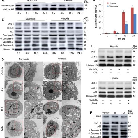 Hmgb1 Protein Analysis And Cell Autophagy Detection A And B Hepg2