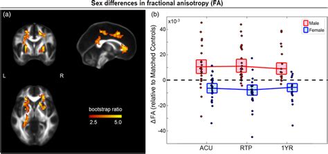 A Brain Areas With Significant Sex Differences In The Effect Of