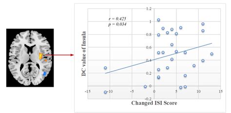 Figure From Real Time FMRI Neurofeedback Training Changes Brain Degree Centrality And Improves