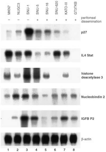 Northern Blot Analysis Of Differently Expressed Genes In Eight Gastric