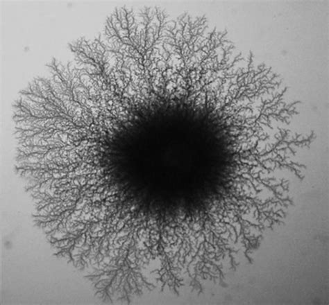 I Could Look At These Pseudohyphae All Day Rlabrats