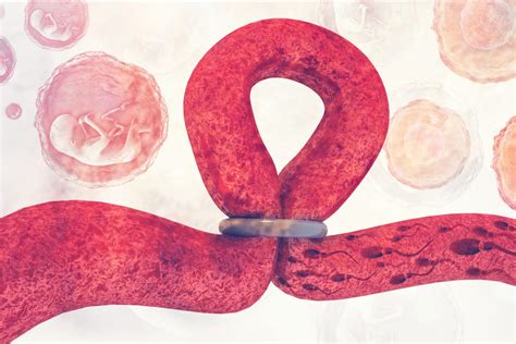 Serous Exudate Definition And Examples Biology Online Dictionary