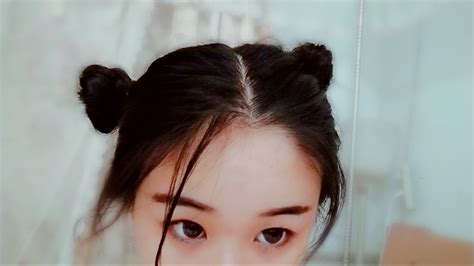 关于我割双眼皮的一些心得 哔哩哔哩