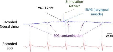 Figure 1 From Extraction Of Evoked Compound Nerve Action Potentials
