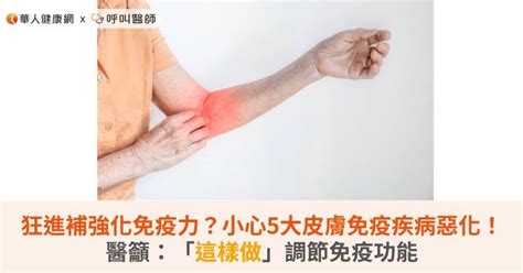 狂進補強化免疫力？小心5大皮膚免疫疾病惡化！醫籲：「這樣」做調節免疫功能 華人健康網 專業即時優質的健康新聞及資訊分享平台業即時優質的