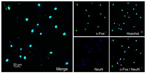 Lactoferrin Modulates Induction Of Transcription Factor C Fos In