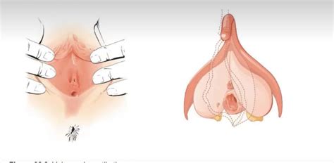 Female Vulva And Erectile Tissues Diagram Quizlet
