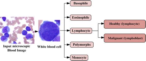 Lymphoblast Vs Lymphocyte