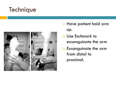 Ppt Bier Block Powerpoint Presentation Free Download Id5122394