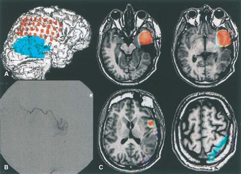 Co Registered Magnetic Resonance Imaging To Helical Computed Tomography Download Scientific