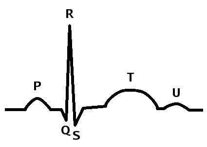 Draw An Ecg Waveform Representing One Heartbeat