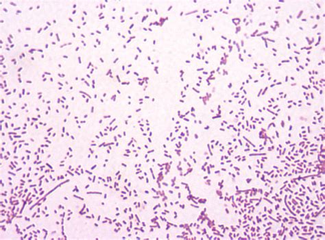 Haemophilus Influenzae Type B Gram Stain
