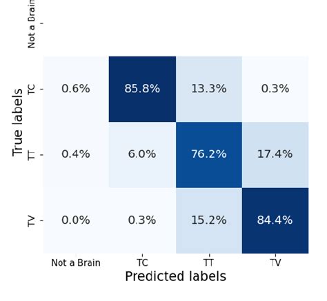 Figure 1 From Exploiting Class Activation Mappings As Prior To Generate Fetal Brain Ultrasound