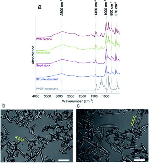 Struvite Structure