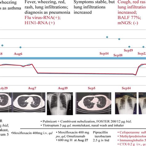 Symptoms Peripheral Blood Eosinophils Pef Ct Image And Treatment