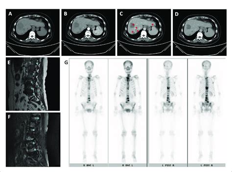 Initial Imaging Examination A D Dynamic Abdominal Computed