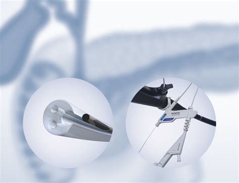 Ercp Procedure Endoscopic Retrograde Cholangiopancreatography