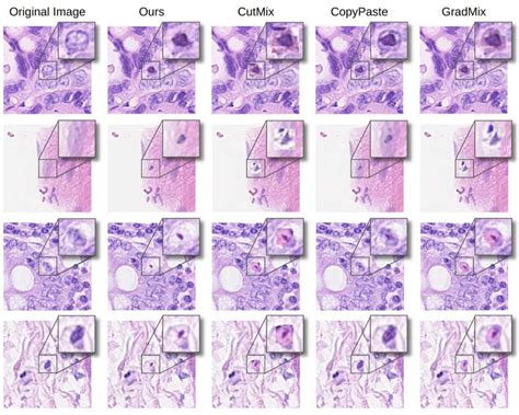 논문 리뷰 Nucleimix Realistic Data Augmentation For Nuclei Instance