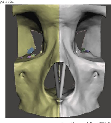 Figure 3 From Design And Printing Of A Low Cost 3d Printed Nasal
