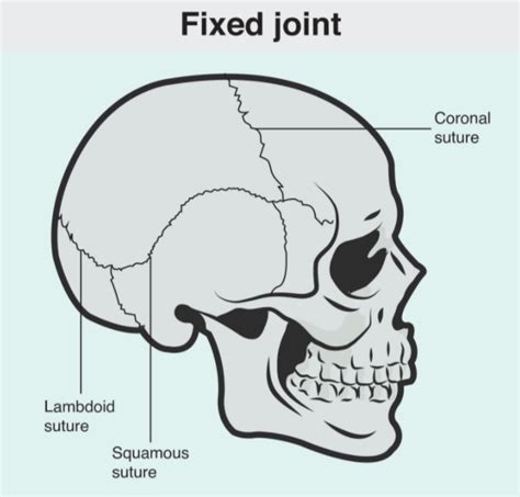 Give An Example Of A Fixed Joint
